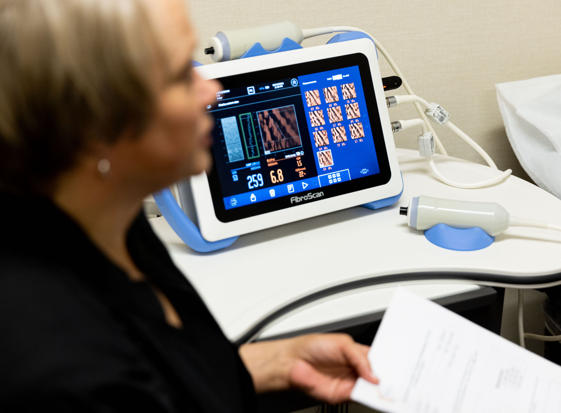 Tests for Liver Disease | When is it Time to Get A Liver Scan?