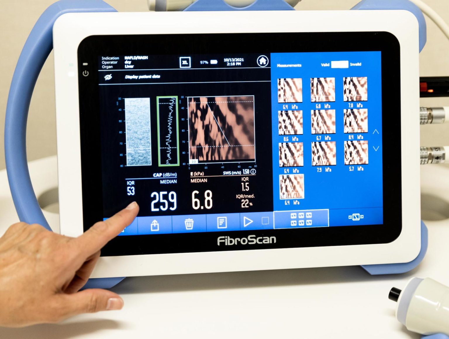 KCRI-Clinical Research Center (CRC),Trial near me Kansas City | Dr ...